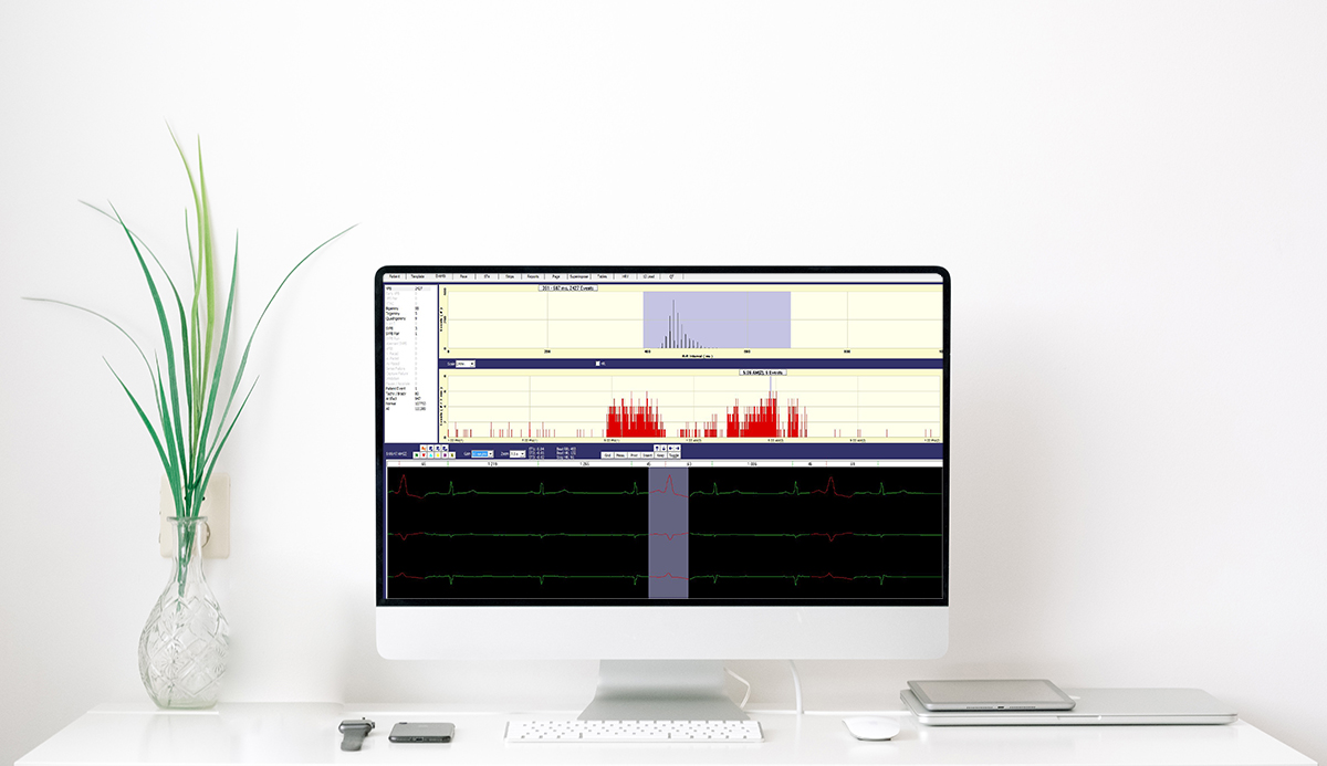 ScottCare Announces HolterCare version 12